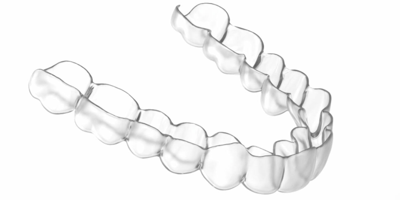 Why In-Office 3D Printed Aligners Is More Affordable & Effective For ...